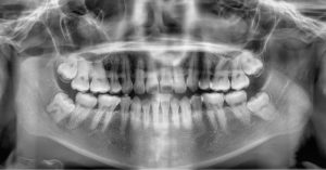 Scientist Figures Out How To Regrow Teeth - The Premier Daily