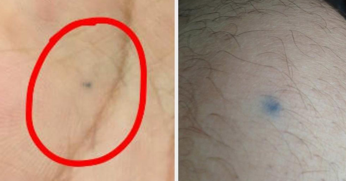 If You Were Stabbed By A Pencil And Still Have A Mark, YOU ARE NOT ...