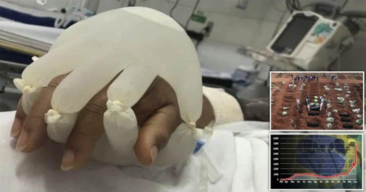 Isolated patients comforted with 'fake hand' so they don't feel alone ...