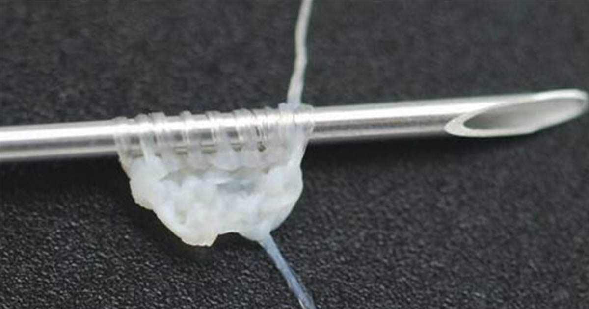 Scientists Grow 'Yarn' From Human Flesh So They Can Stitch People Up ...