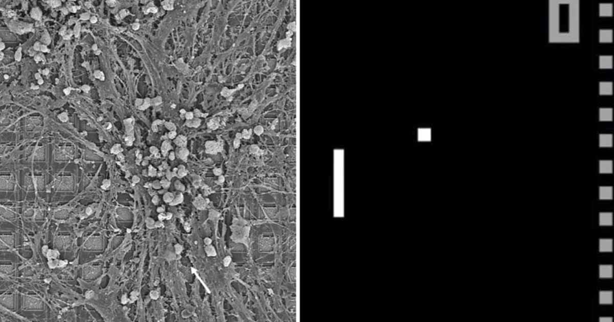 Lab-Grown Brain Cells Learned To Play Video Game 'PONG' In 5 Minutes