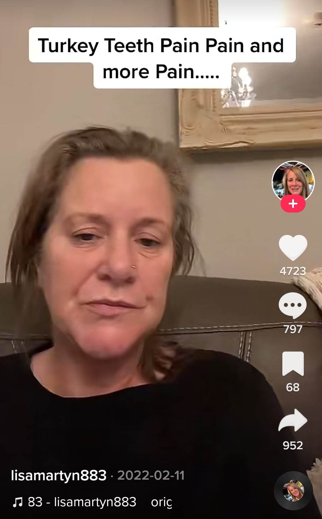 'Our 'Turkey teeth' cost us $4,800 and look lovely but they've ruined ...