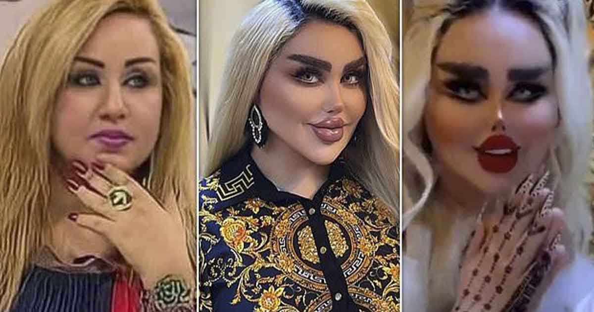 Dalia Naeem: The Barbie Doll Lookalike Who’s Had 43 Cosmetic Procedures