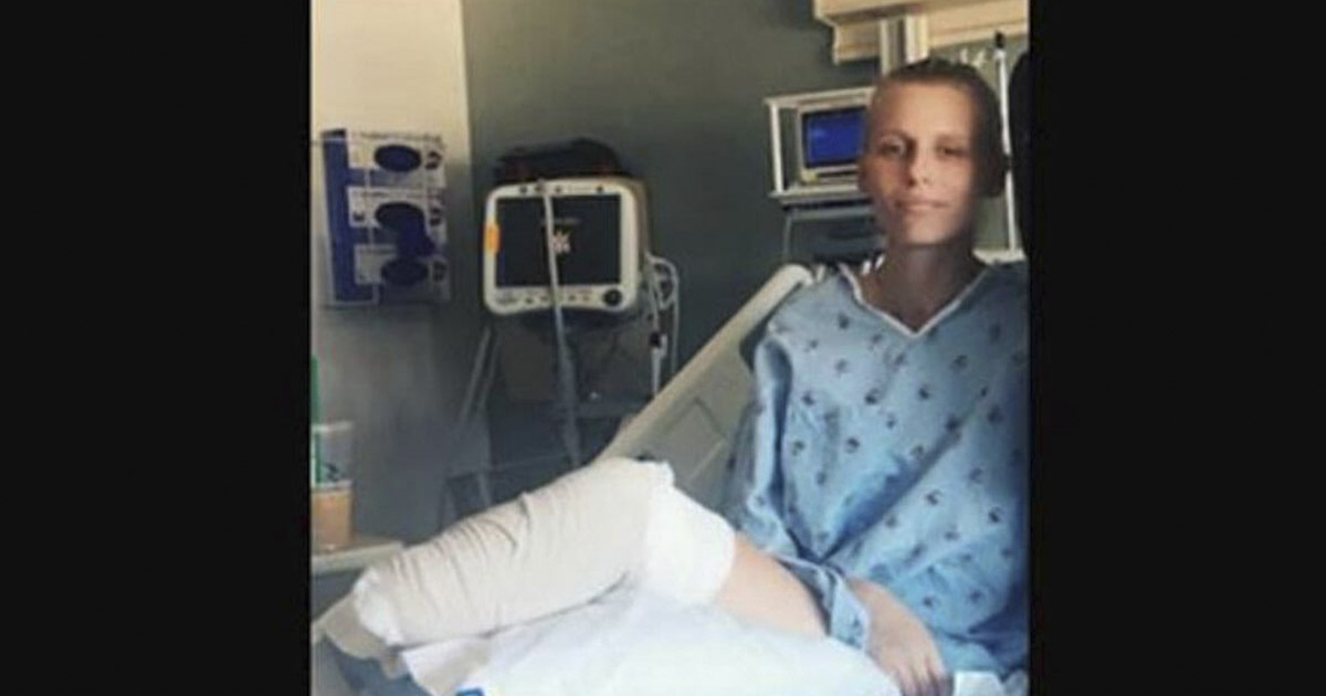 Model was minutes from death and lost both of her legs due to her toxic ...