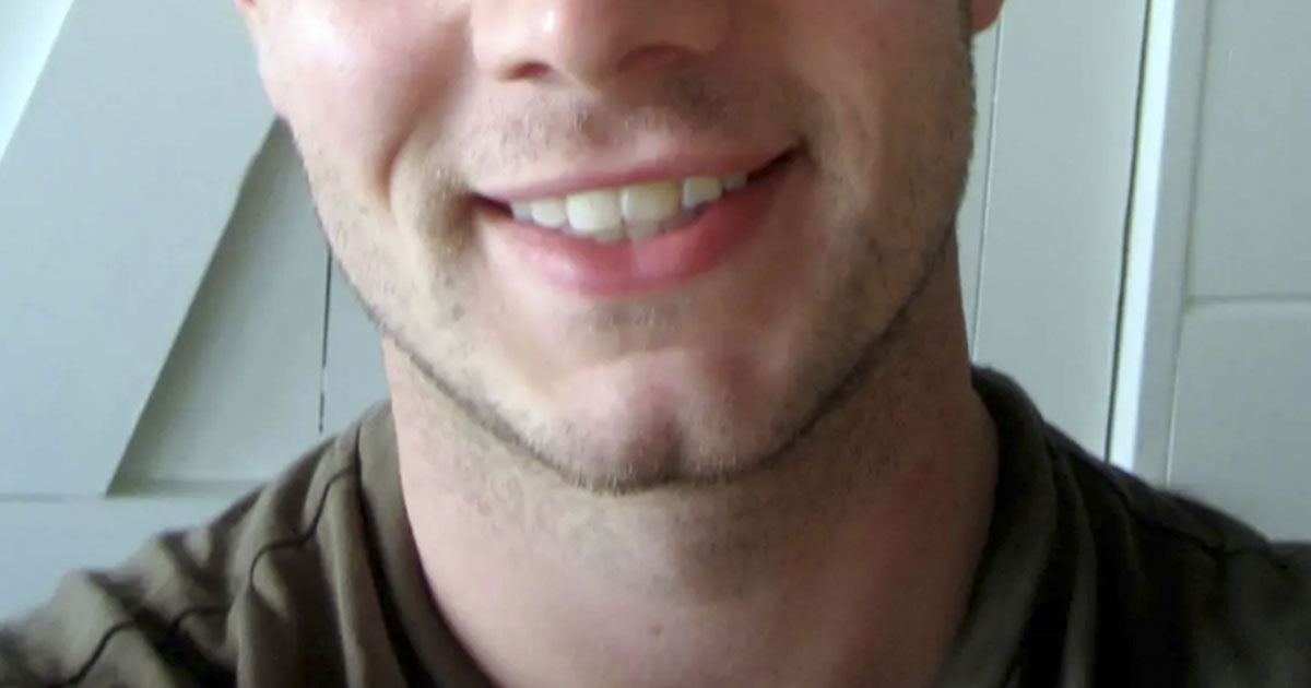 What are Chin Dimples? : The Premier Daily