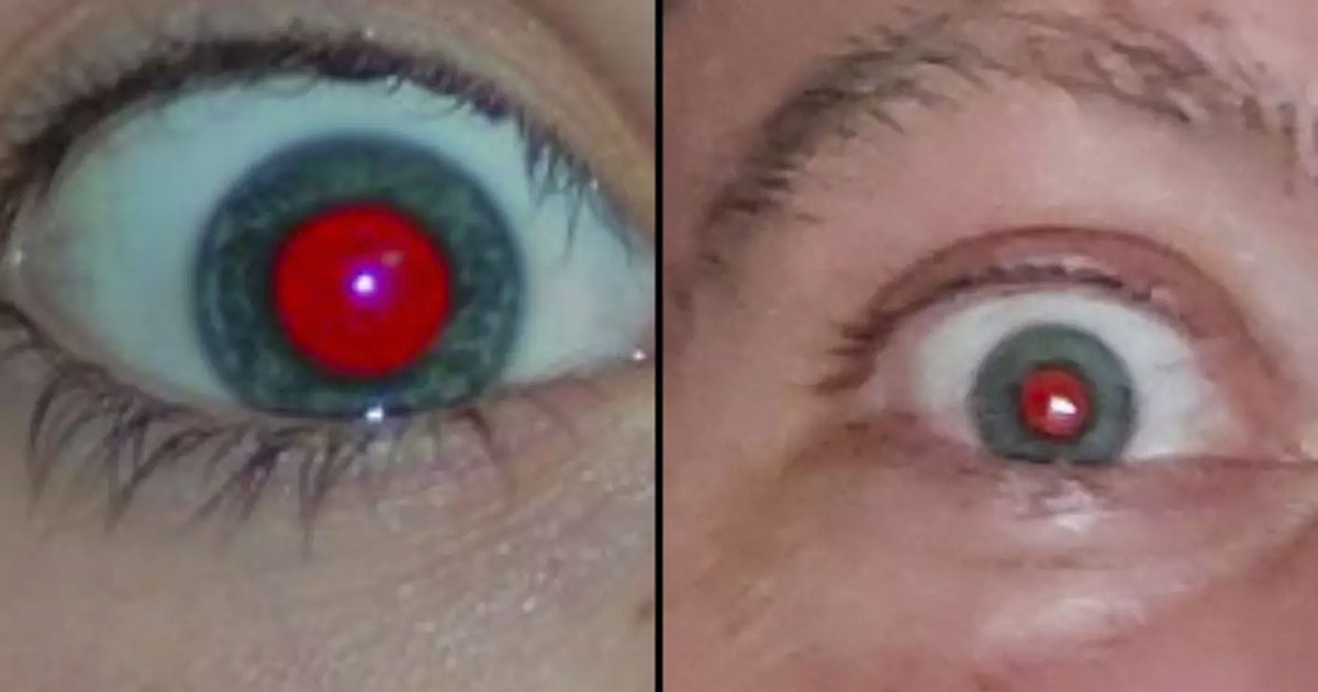 People Disturbed After Learning What Causes “Red Eye” In Photos