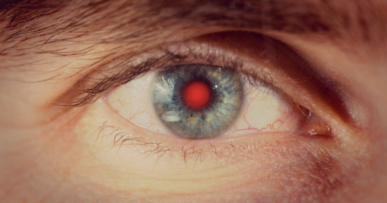 People Disturbed After Learning What Causes “Red Eye” In Photos : The ...